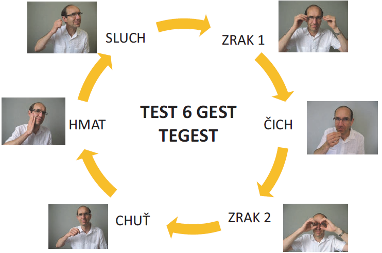 Two original Cze... | Česká a slovenská neurologie a neurochirurgie